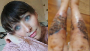The Kelly Ronahan Case: Exploring the Reality of Munchausen Syndrome ...