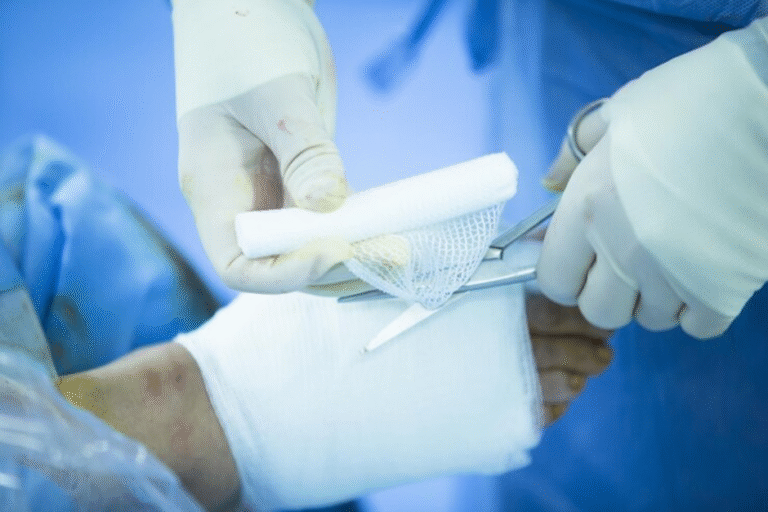 How Long Recovery Takes After Scaphoid Fracture Surgery - News Pioneer